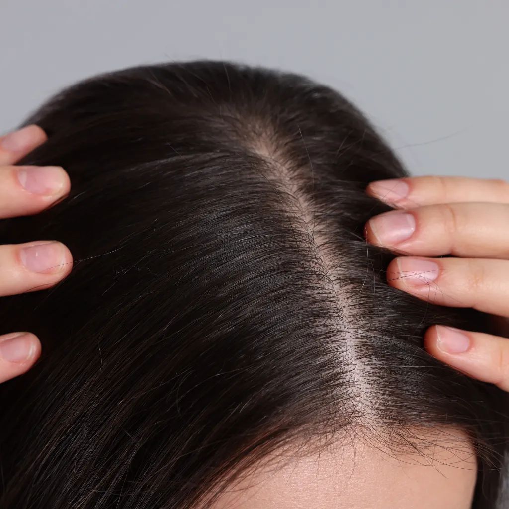 Why is the scalp key to healthy hair? – HACT